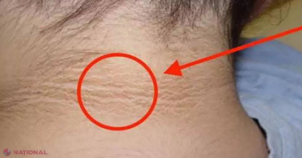 Ce apare pe piele când ai diabet: ȘAPTE simptome îngrijorătoare