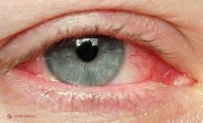 A fost diagnosticat cu CANCER la ochi din cauza obiceiului banal pe ...